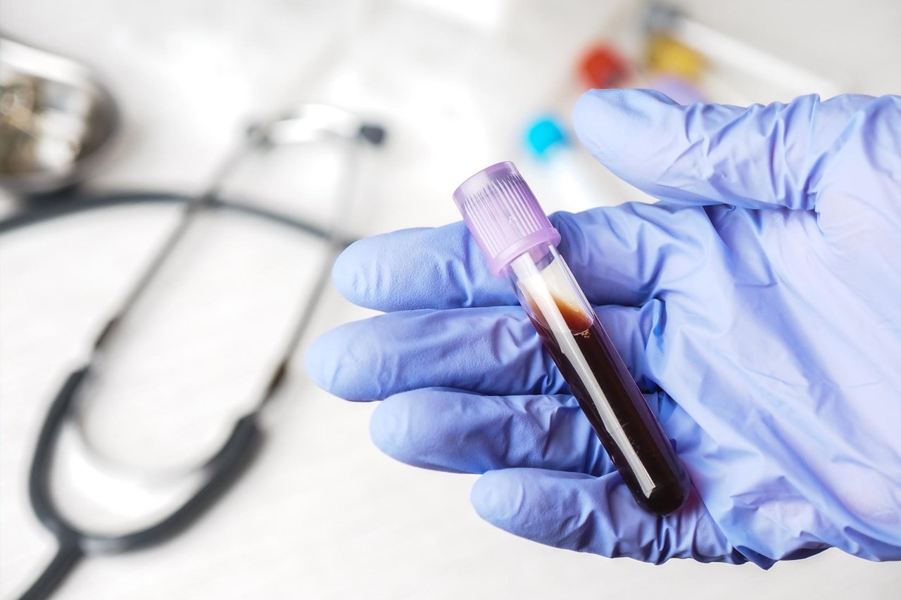 Leucemia linfocítica crónica: desconocimiento de los síntomas sigue ... Leucemia linfocítica crónica: desconocimiento de los síntomas sigue ...