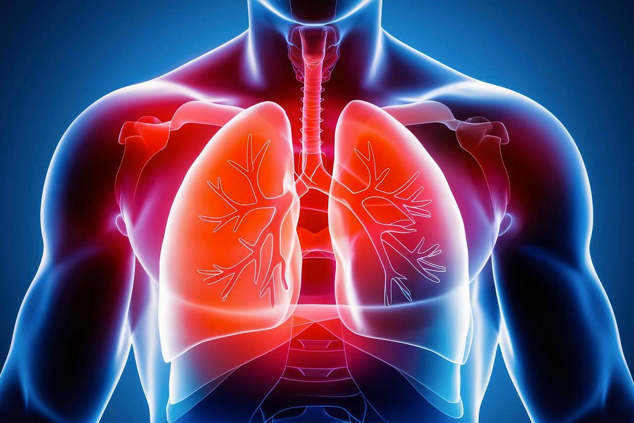 Conozca más sobre el neumococo y las opciones de prevención en Colombia ...